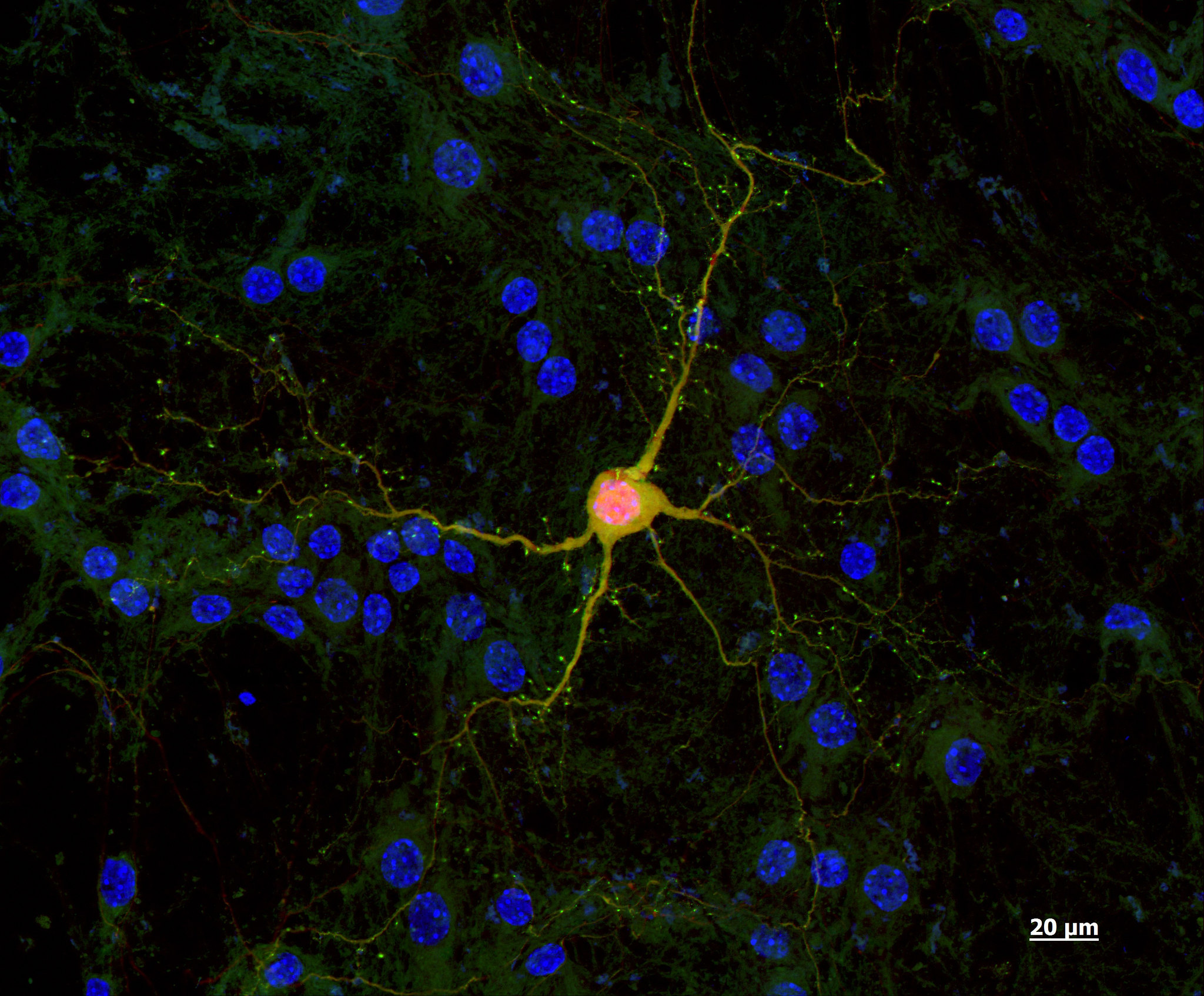 Does life flash before your eyes? • theGIST